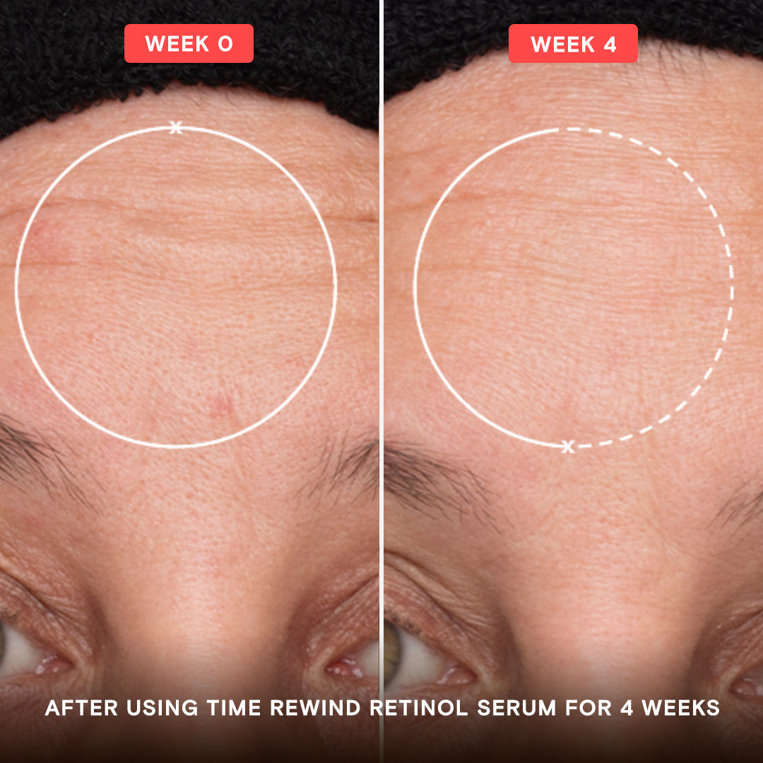 Time Rewind Retinol Power- Exponent Beauty Skincare Serums